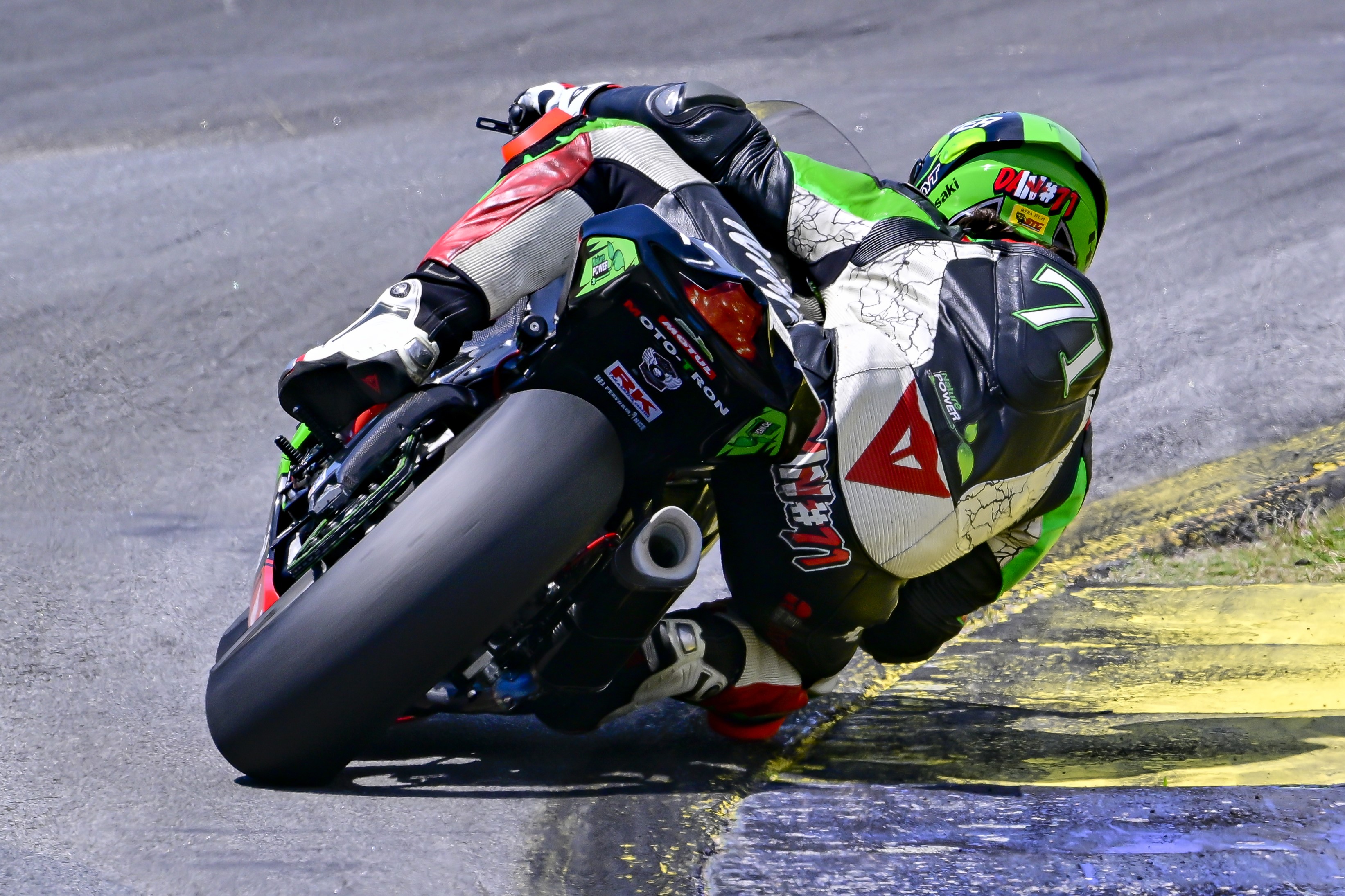 ISET 2025: Pioneering the future of endovascular therapy | HMP Global